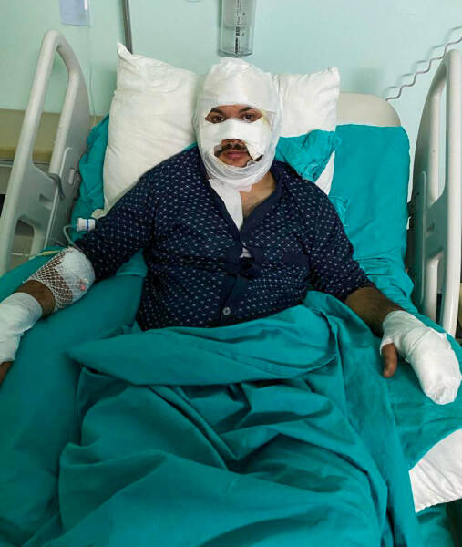 ANF | Çelik imalathanesinde işçiler göz göre göre hayatını kaybetti!